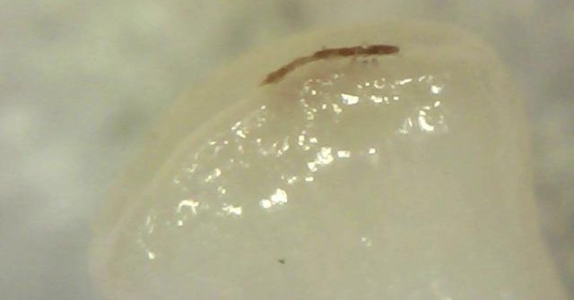 Tête de tenia ou tænia - Les Taxinomes